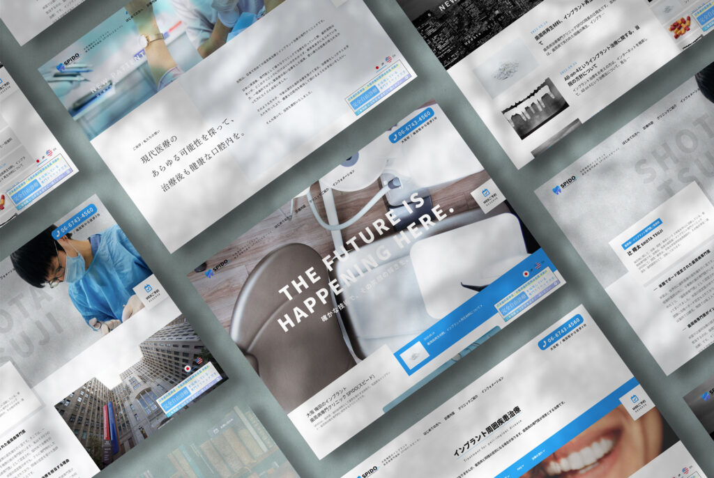 SPIDO - Ceep(シープ)